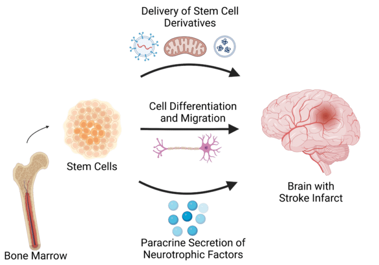 Stem Cell Implants: Emerging Innovation