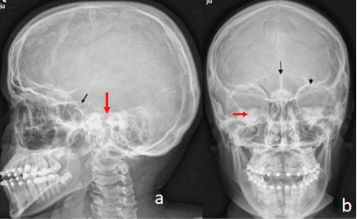 Understanding Is the Core of Skeletal Diagnosis....