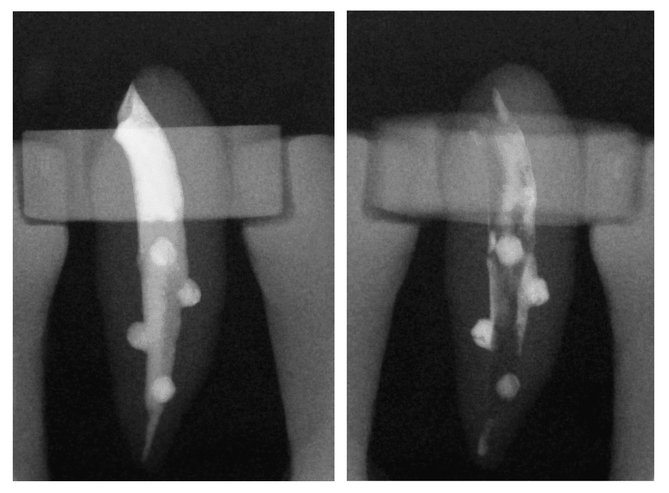 Efficacy of Different Manual and Sonic Agitation