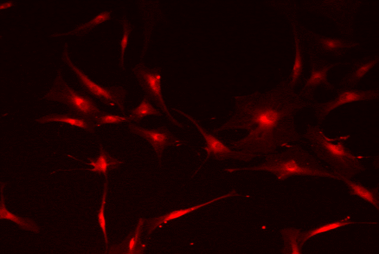 Microwave Radiations on Mesenchimal Stem Cells