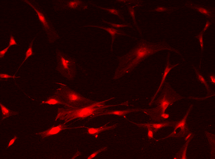 Microwave Radiations on Mesenchimal Stem Cells